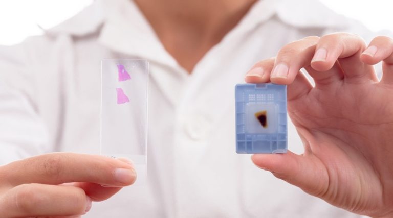 FFPE Human Tissue: A Complete Guide - The Good Mother Project